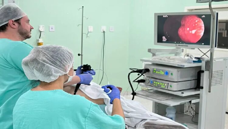 Colonoscopia é essencial no diagnóstico do câncer de intestino